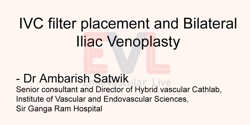 Venography with balloon Venoplasty Stenting of IVC and B/L Iliac vein ...